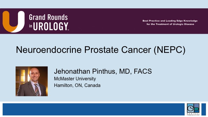 Dr. Jehonathan Pinthus | Neuroendocrine Prostate Cancer (NEPC)