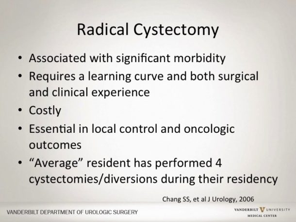 Sam S. Chang | Robotic Cystectomy Versus Open Cystectomy