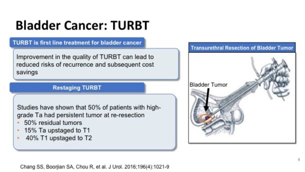 Dr. Michael Cookson | Enhanced Techniques of Non-Muscle Invasive ...