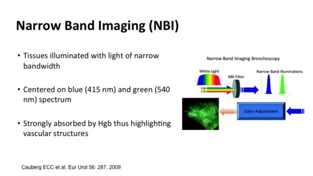 Dr. Michael Cookson | Enhanced Techniques of Non-Muscle Invasive ...