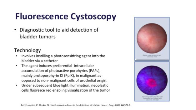 Dr. Michael Cookson | Enhanced Techniques of Non-Muscle Invasive ...