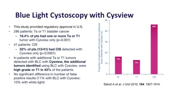 Dr. Michael Cookson | Enhanced Techniques of Non-Muscle Invasive ...