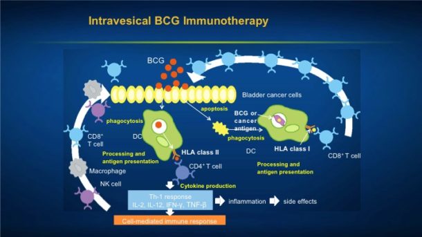 Leonard G. Gomella | Basic Concepts in Bladder Cancer Immunotherapy