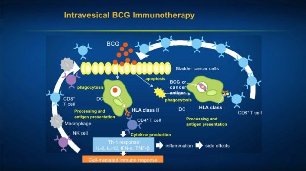 Leonard G. Gomella | Basic Concepts in Bladder Cancer Immunotherapy