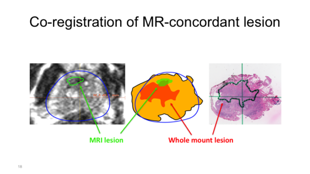 The Ups and Downs of MRI Interrogation of the Gland