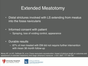 Chris Gonzalez | Management of Lichen Sclerosus Related Urethral Strictures