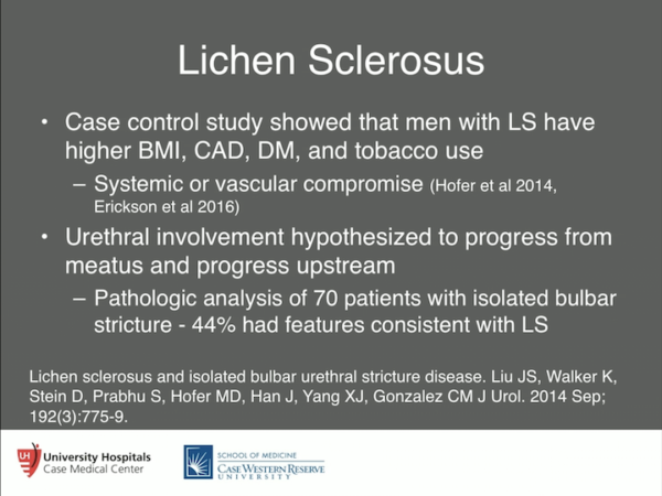 Chris Gonzalez Management Of Lichen Sclerosus Related Urethral Strictures