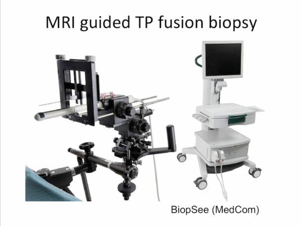 Roberto Miano, MD | Transperineal Prostate Biopsy: State of the Art