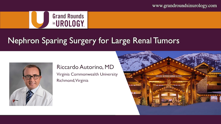 Dr. Riccardo Autorino | Nephron Sparing Surgery for Large Renal Tumors