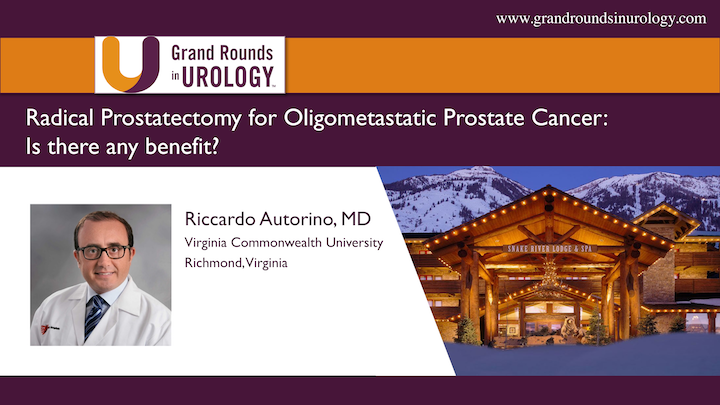 Radical Prostatectomy for Oligometastatic Prostate Cancer: Is There Any ...