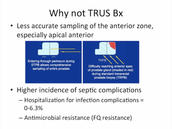 Roberto Miano, MD | Transperineal Prostate Biopsy: State of the Art