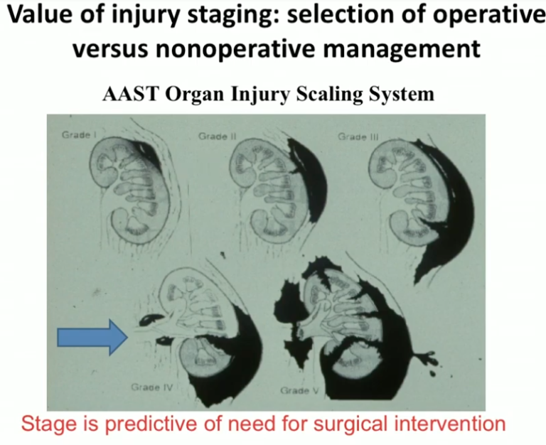 Michael Coburn, MD | Management of High Grade Renal Trauma