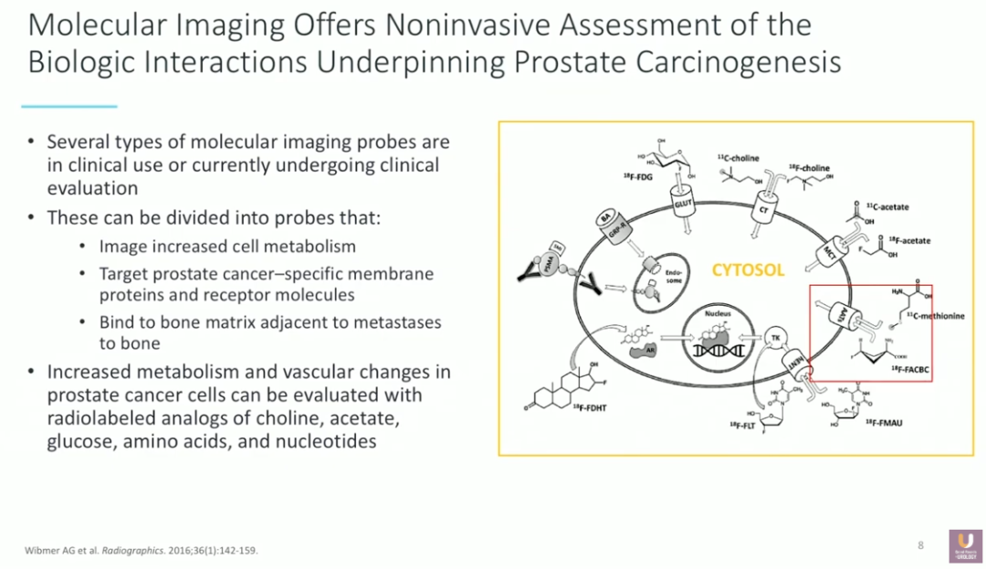 Fluciclovine 18F PET-CT Impact on Clinical Management of Recurrent PCa