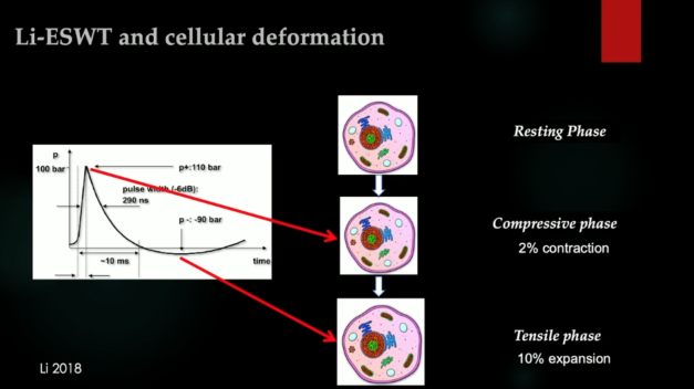 Shockwave Therapy for ED: Miracle or Hype? | Li-ESWT