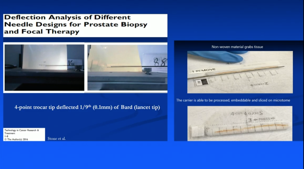 Image Guided Prostate Biopsy | Gerald L. Andriole, MD, FACS | Video