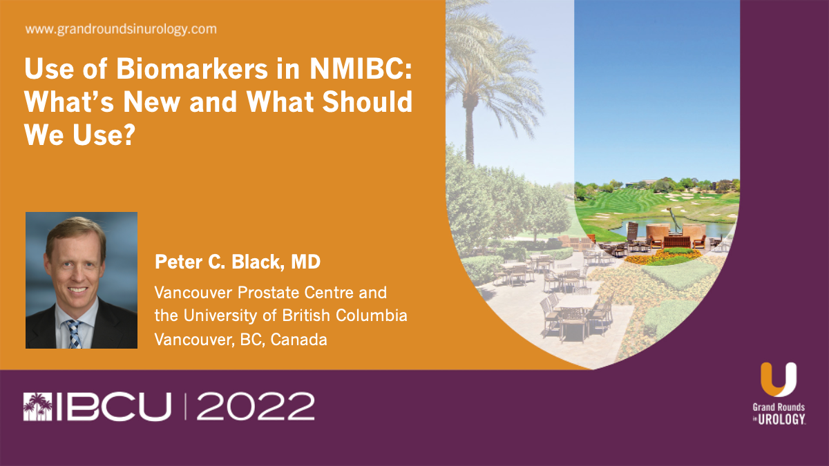 Use of Biomarkers in NMIBC: What’s New and What Should We
