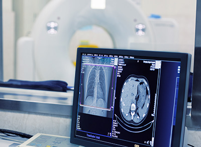 Next-Generation Focal Therapy Learning Center