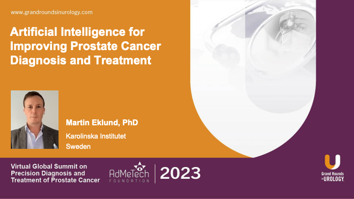 Artificial Intelligence and Prostate Cancer Diagnosis and Treatment